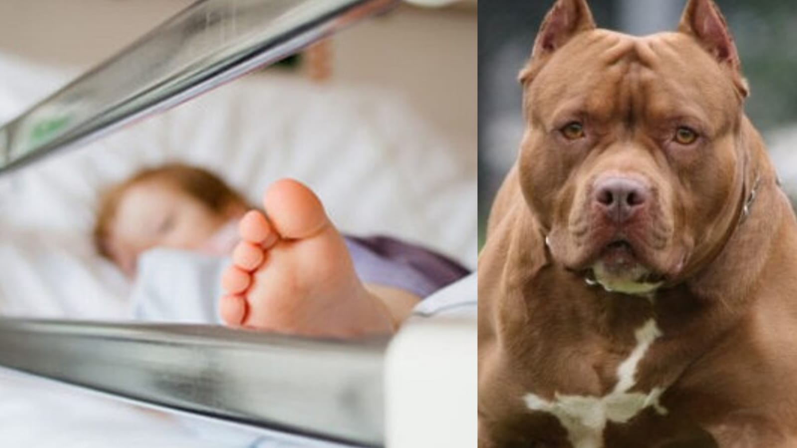 Bambino di un anno morso al viso da cane, trasportato d'urgenza al ...